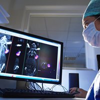 Oncodesign, experts in precision medicine | Discover Oncodesign